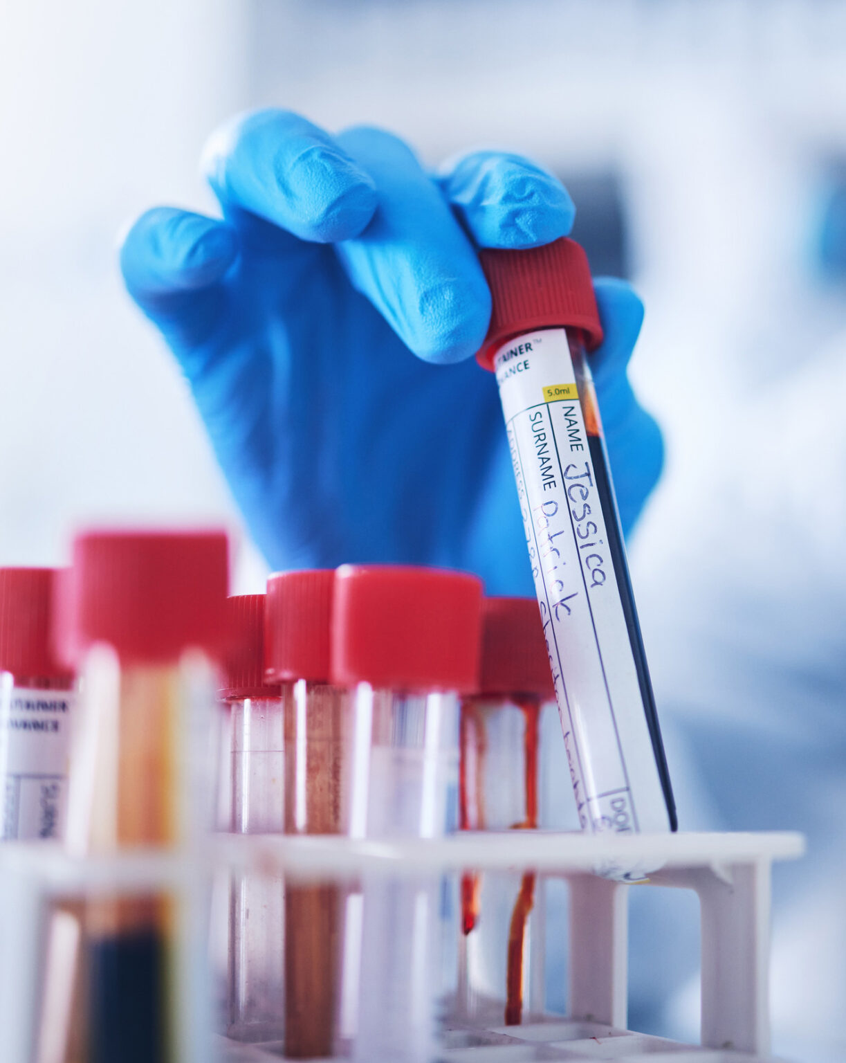 Colorado Functional Medicine | Lab Tests